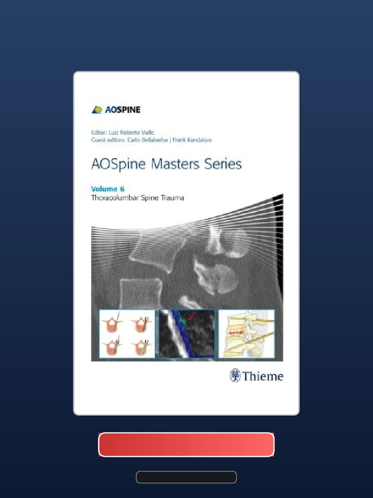 AOSpine Masters Series Volume 6 Thoracolumbar Spine Trauma Test Bank ...