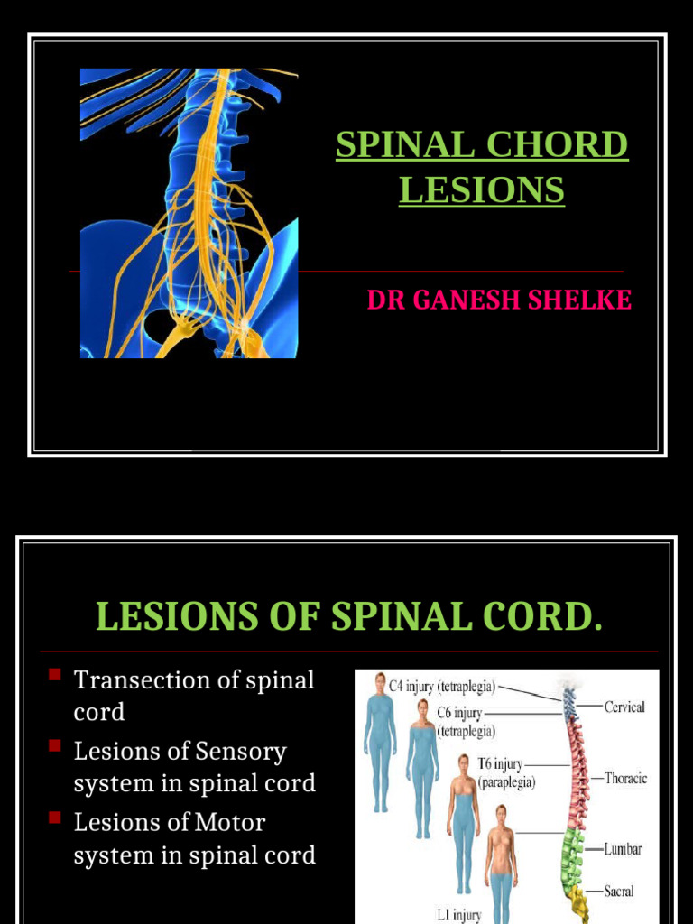 Spinal Cord Lesions Overview | PDF | Spinal Cord | Spinal Cord Injury