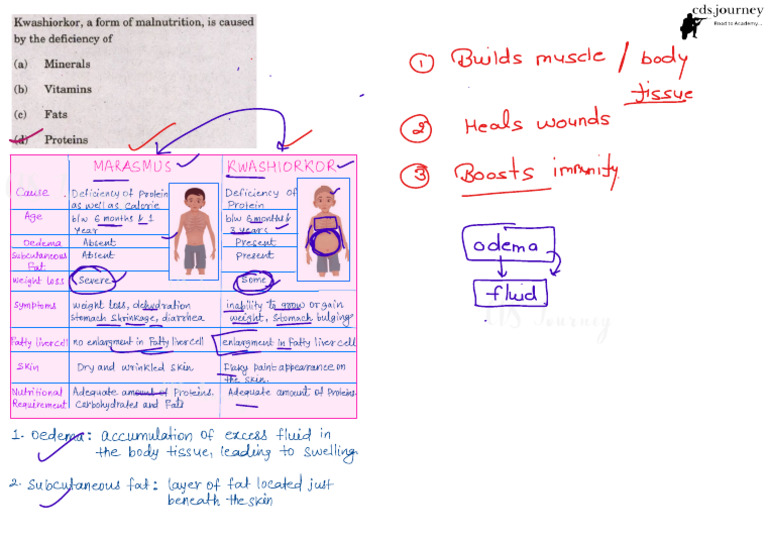 One Pager - Protein Deficiency. | PDF