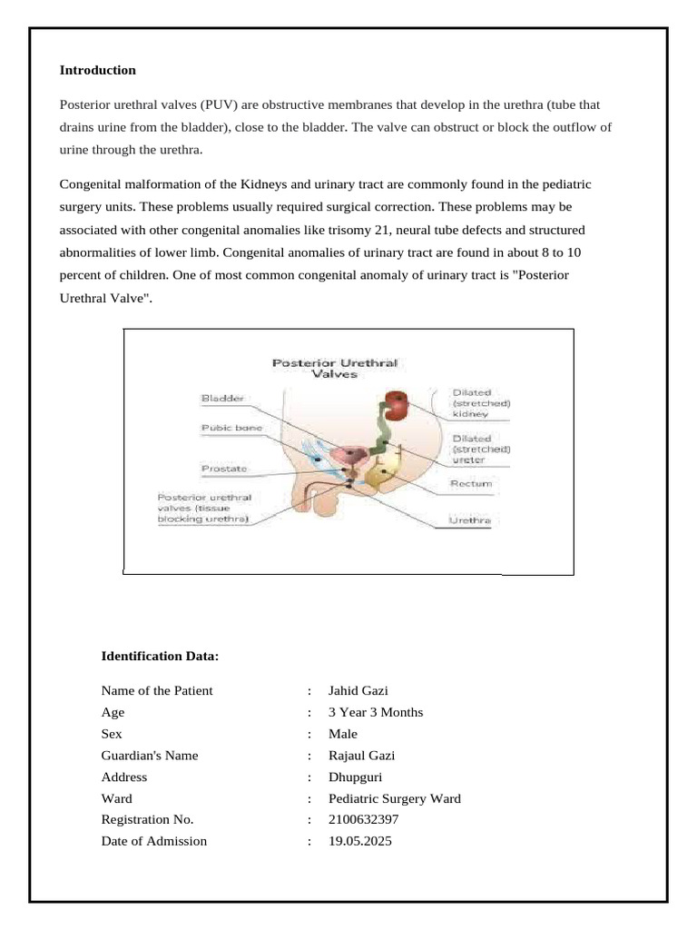 Posterior Urethral Valves in Children | PDF | Medical Specialties ...
