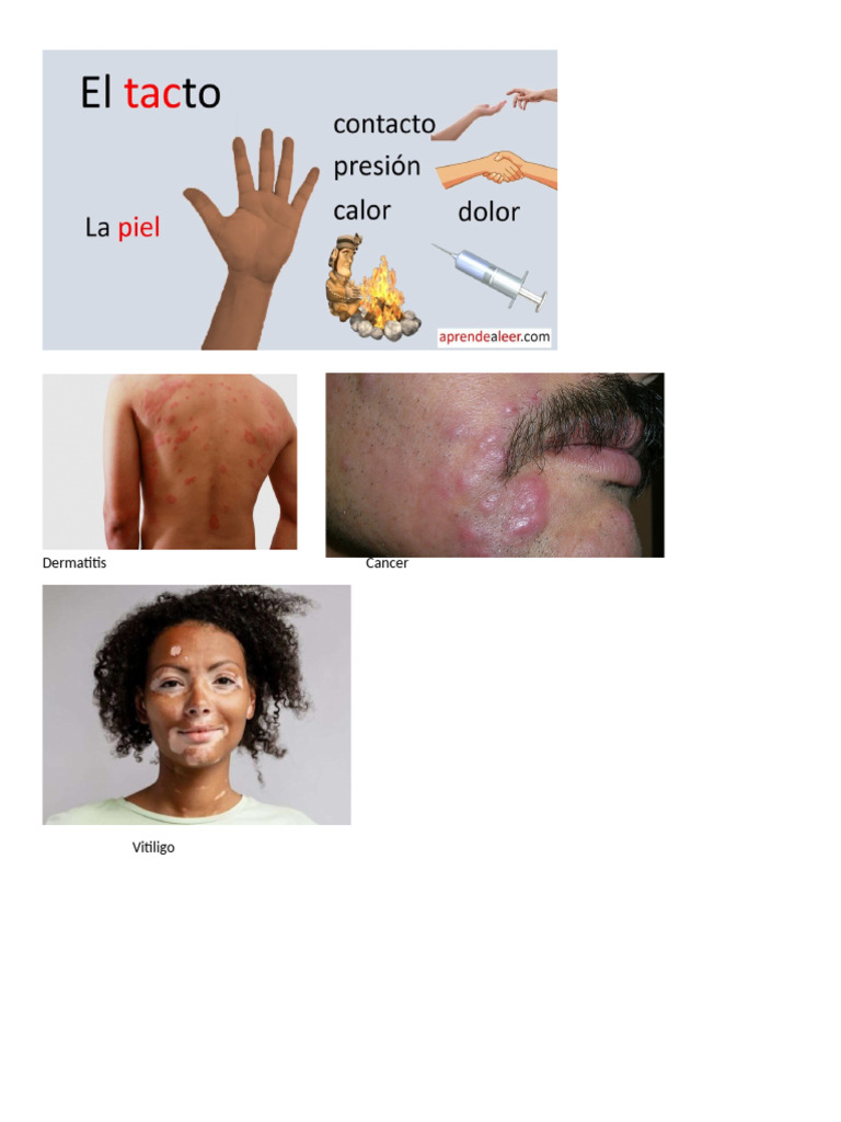 Dermatitis | PDF