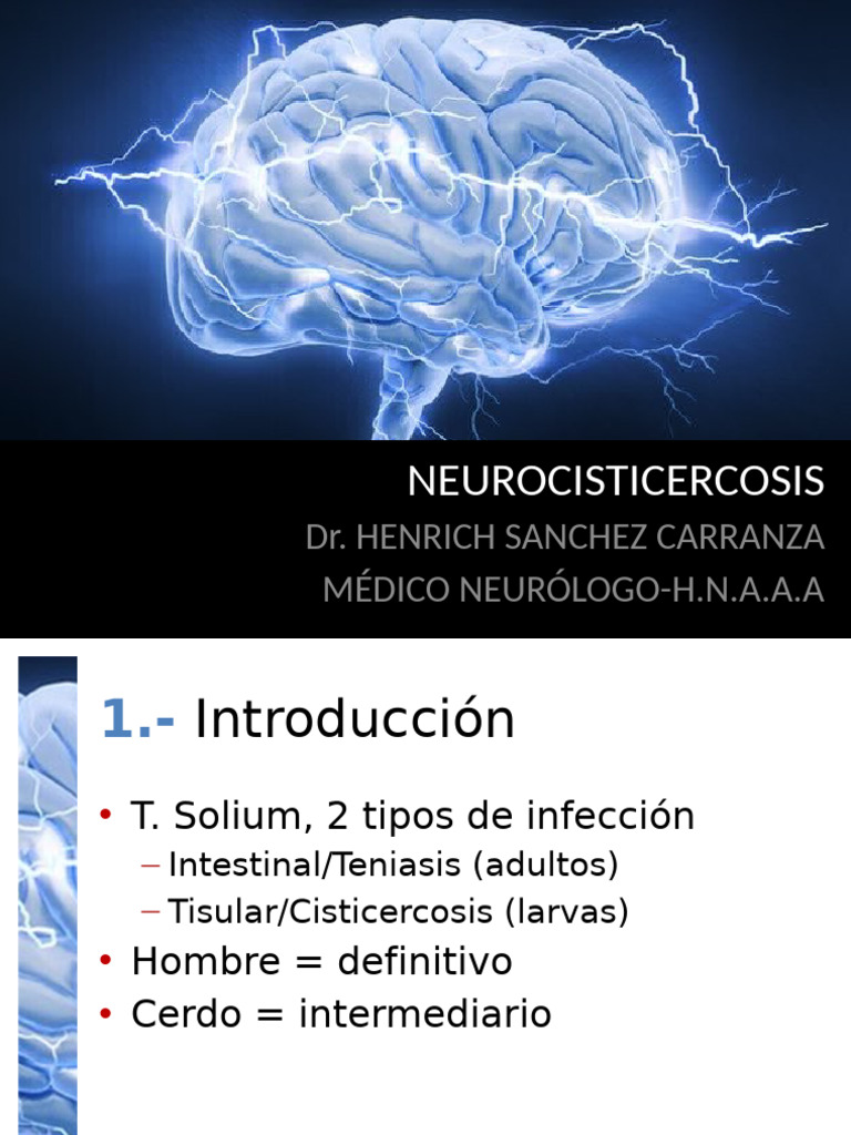 Neuro Cist Icer Cos Is | PDF | Medicina CLINICA | Especialidades Medicas