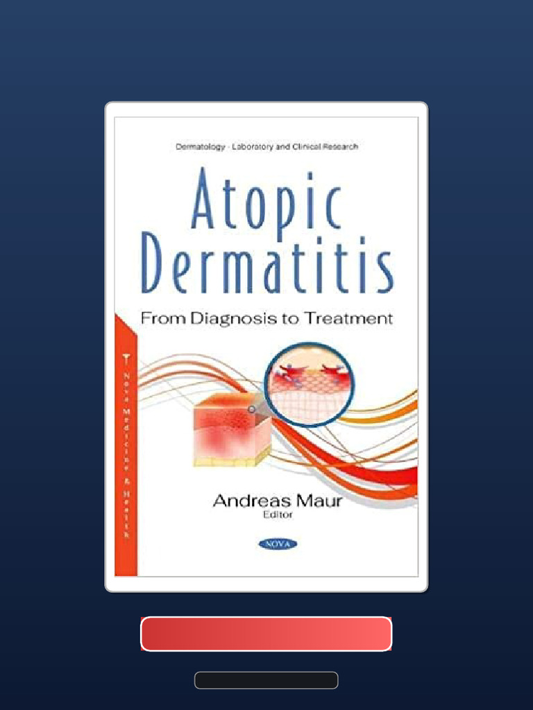Atopic Dermatitis From Diagnosis To Treatment Test Bank Available ...