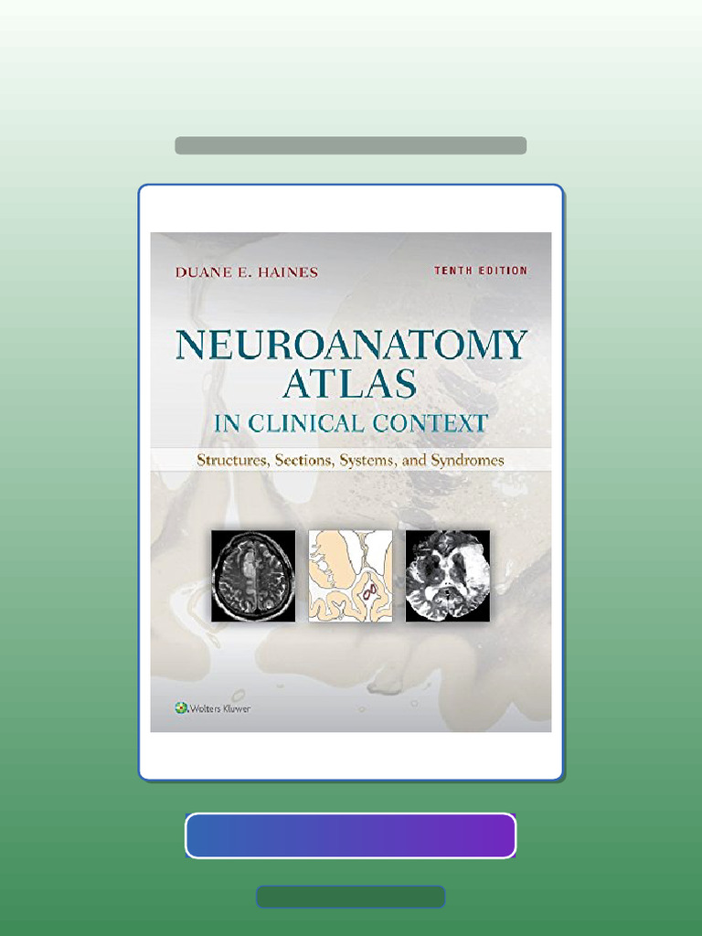 Neuroanatomy Atlas in Clinical Context Structures Sections Systems and ...