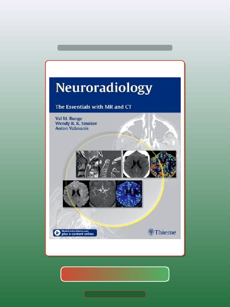 Neuroradiology The Essentials With MR and CT | PDF | Radiology