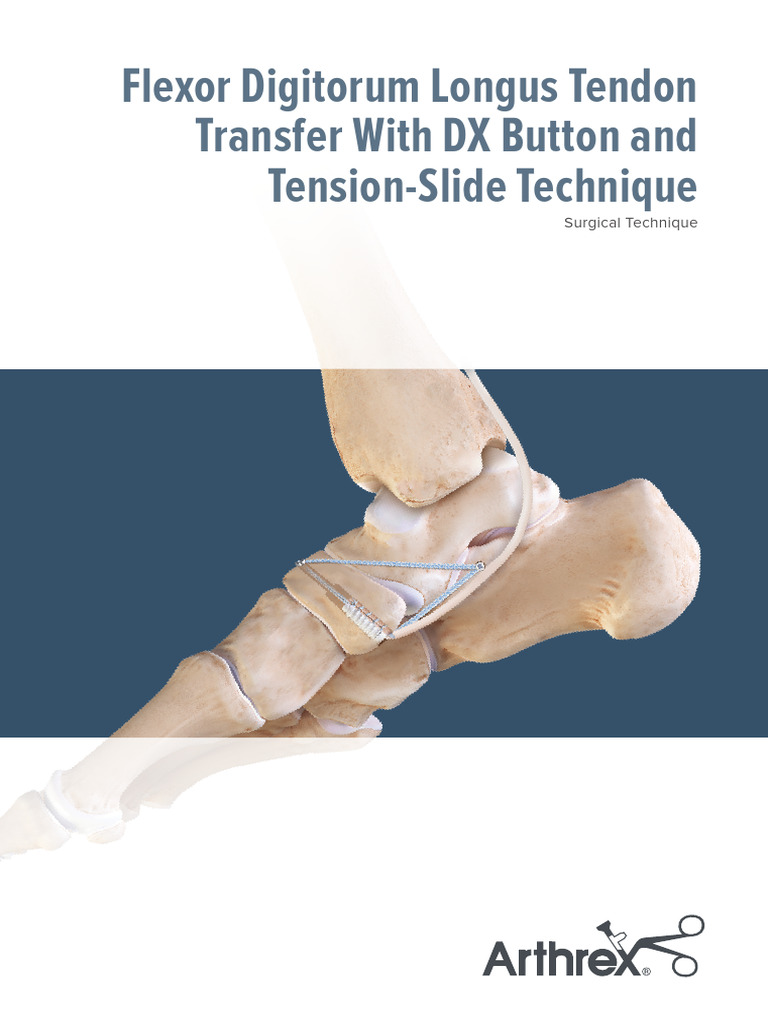 FDL Tendon Transfer with Tension-Slide Technique | PDF | Surgical ...
