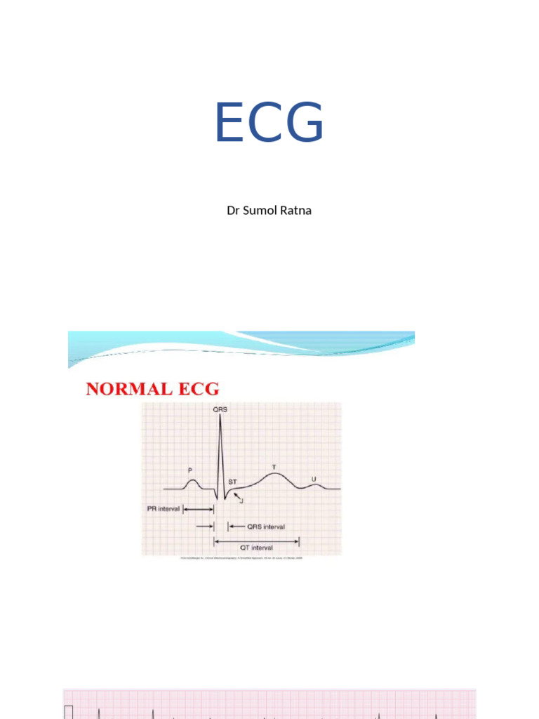 Ecg 2 | PDF