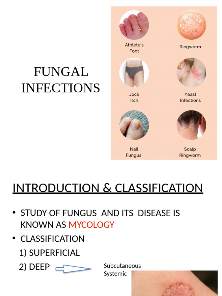 FUNGAL Hiv Scabies Ug | PDF | Clinical Medicine | Cutaneous Conditions
