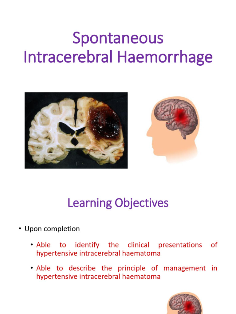Intracranial Bleed - Notes | PDF
