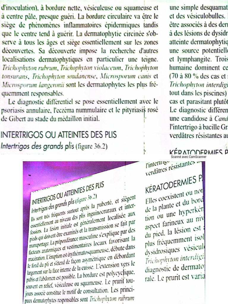 Intertrigos Des Plis | PDF