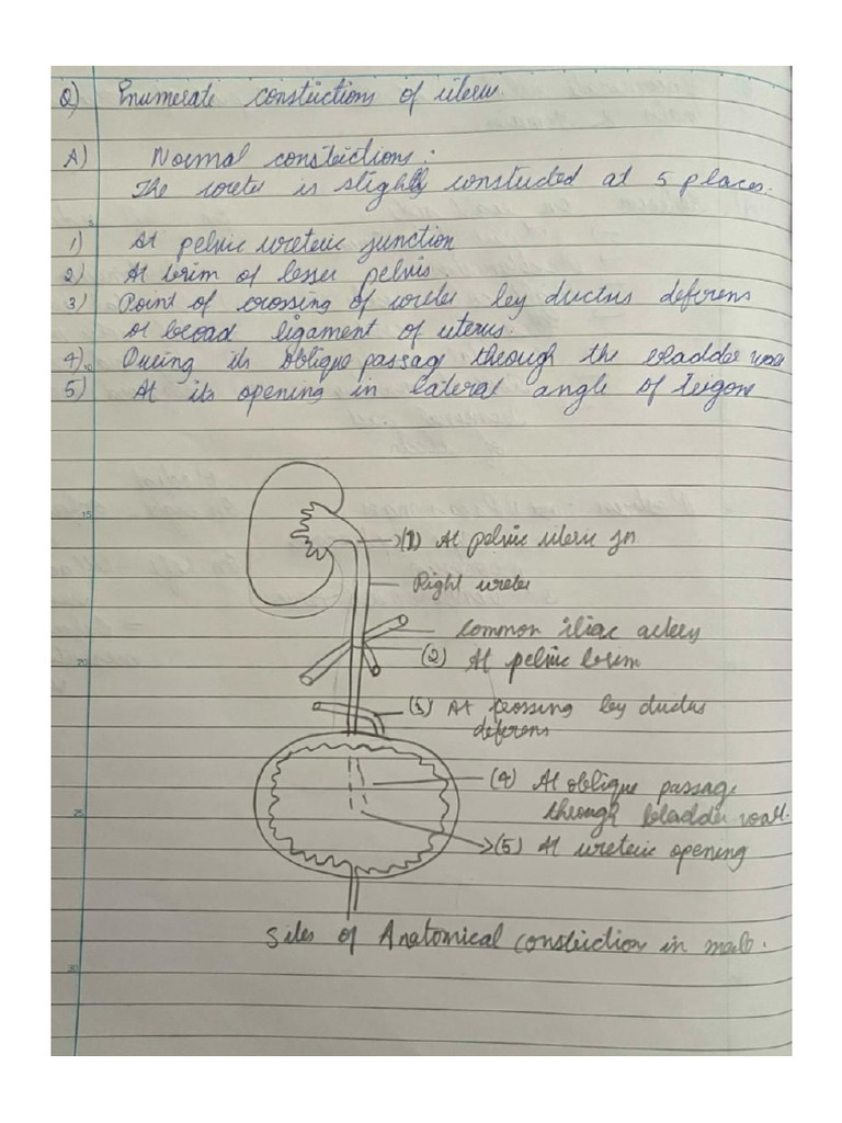 Prappyo Pramanik 24m160 Ureter Sdl. | PDF
