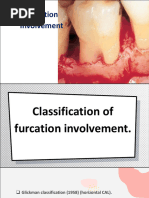 Furcation Involvement Management Guide | PDF | Periodontology | Mouth