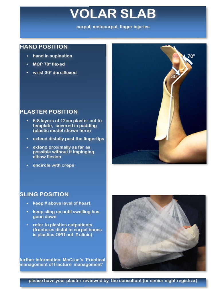 Volar Slab Positioning for Hand Injuries | PDF