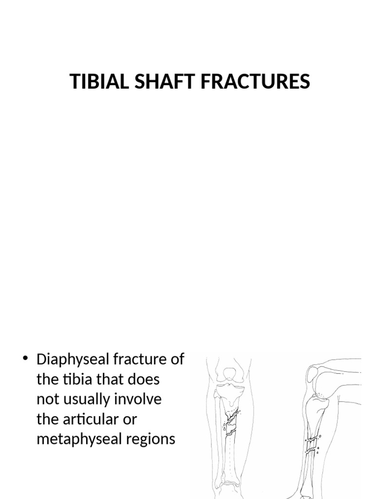 Tibial Shaft Fracture Management Guide | PDF | Skeletal System | Human ...