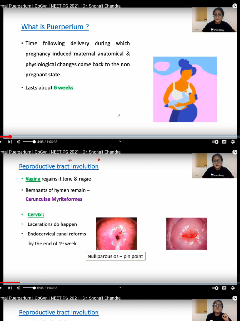 Normal Puerperium, Retained Placenta, Uterine Inversion | PDF