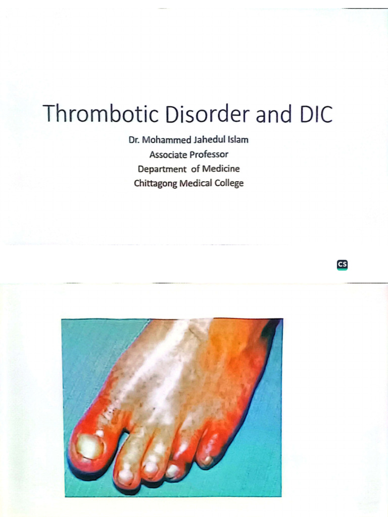 Thrombotic Disorder and Dic | PDF