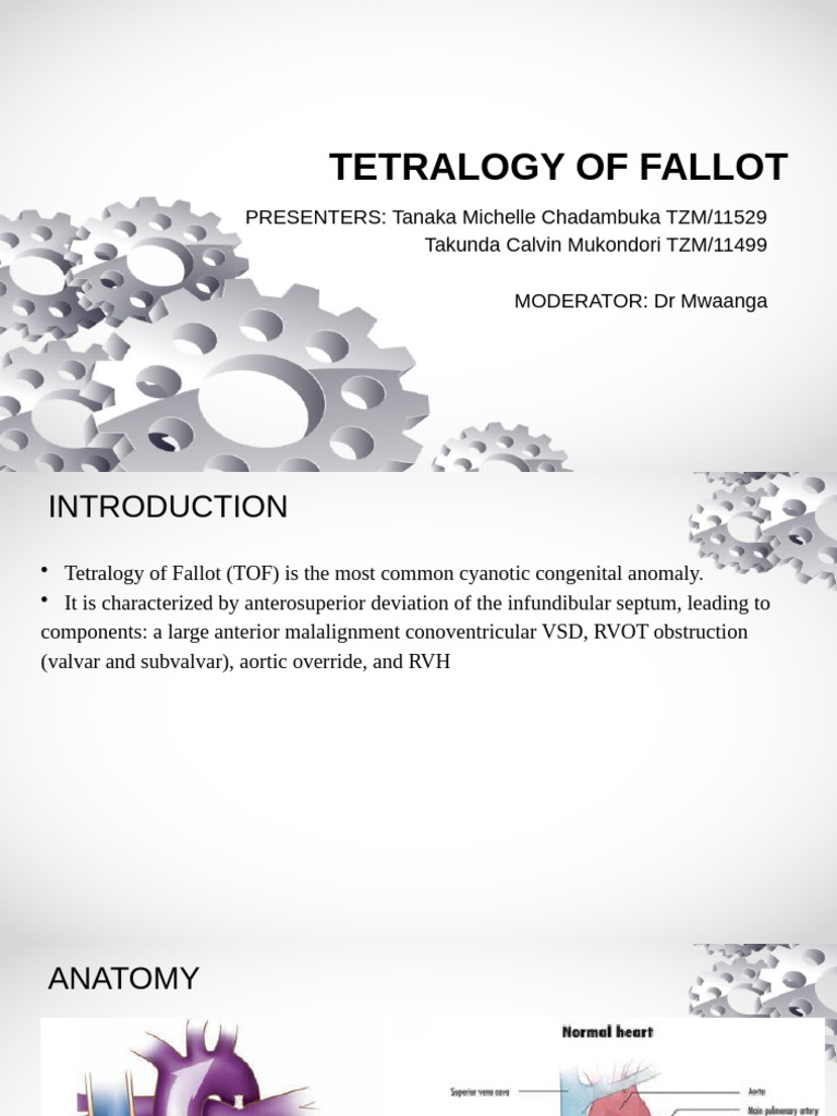 Tetralogy of Fallot Pathophysiology and Clinical Management | PDF | Congenital Heart Defect ...