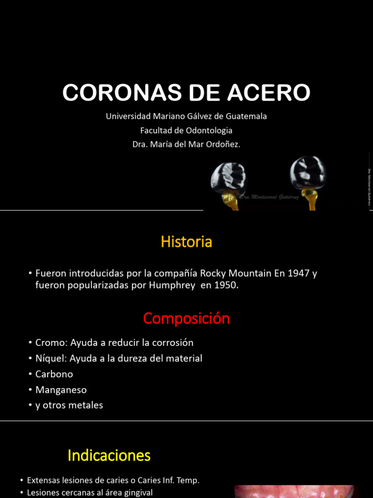 Guía Completa sobre Coronas de Acero | PDF | Diente | Odontología