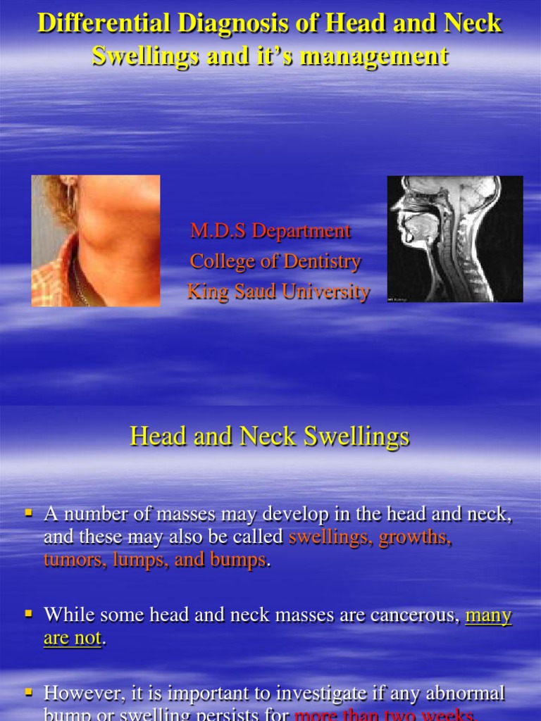 Differential Diagnosis of Head and Swelling | Head And Neck Cancer ...