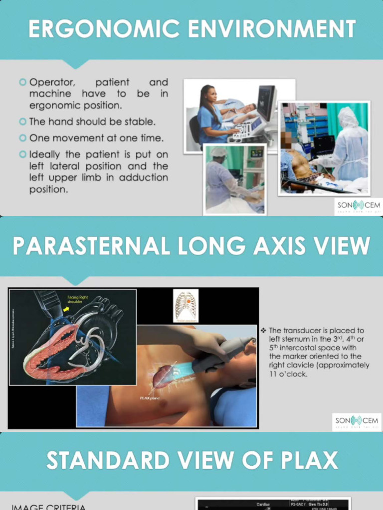 Cardiac USG | PDF