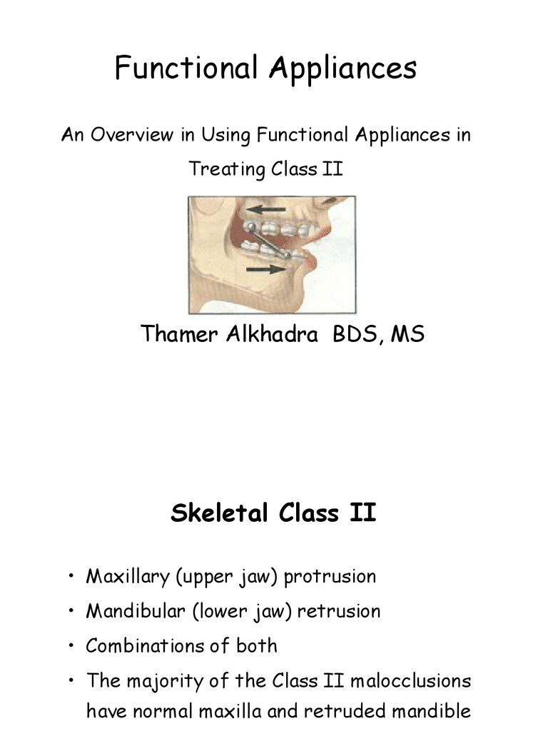 Functional Appliances: An Overview of Using Functional Appliances in ...