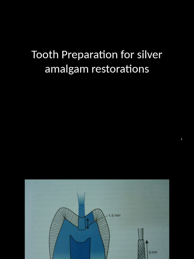 Amalgam - Cavity Preparations | PDF | Tooth Enamel | Tooth