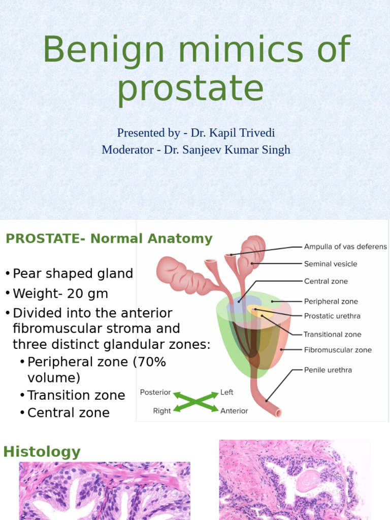 Benign Mimics of Prostate | PDF | Prostate | Epithelium
