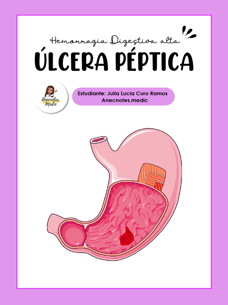 Hemorragia Digestiva Alta y Úlcera Péptica | PDF | Enfermedades y ...
