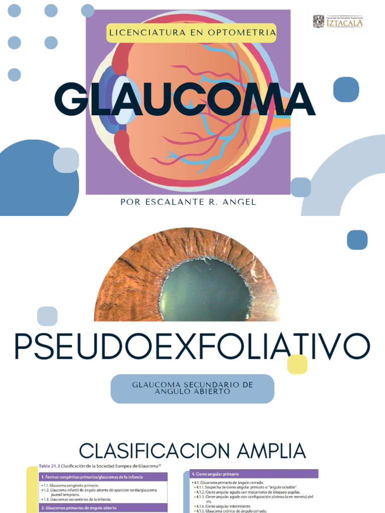 Algunos Subtipos de Glaucoma | PDF | Glaucoma | Catarata