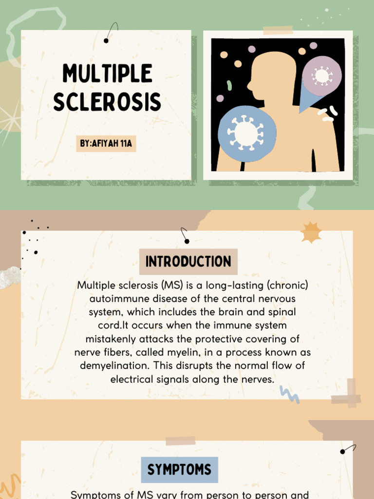 Multiple Sclerosis | PDF | Multiple Sclerosis | Nerve