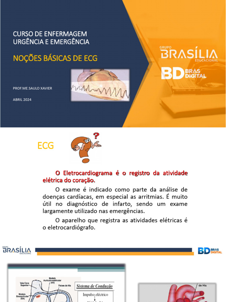 Noções de ECG-2024.1 | PDF | Coração | Infarto do Miocárdio