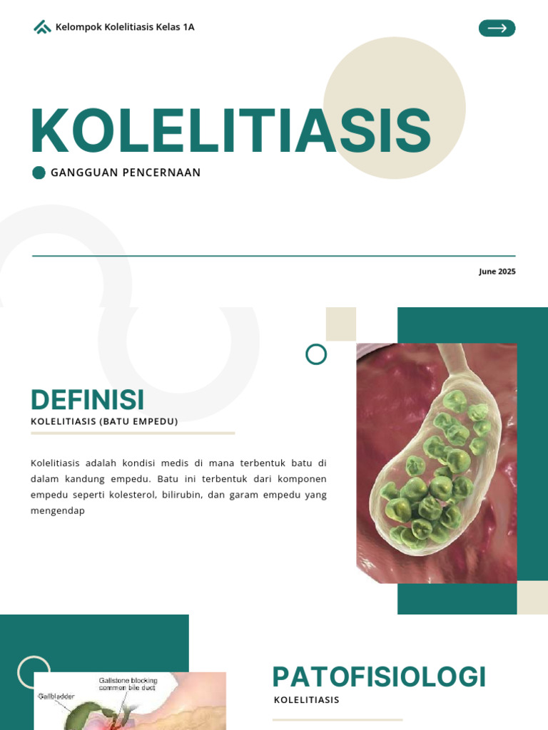 Kolelitiasis | PDF