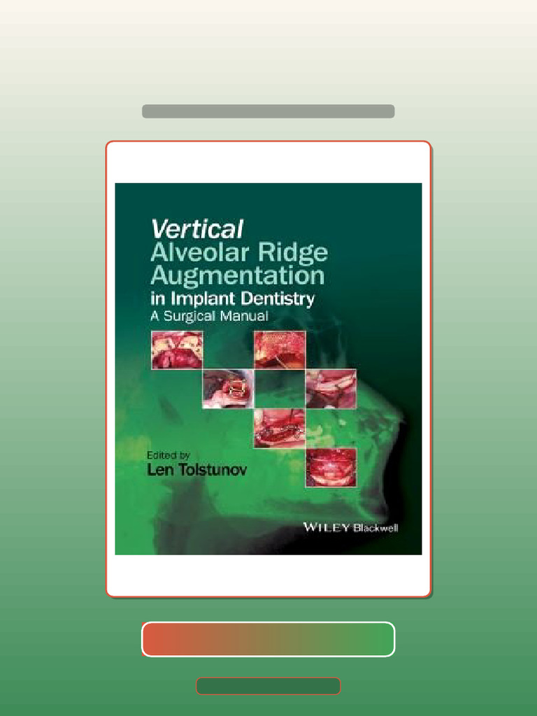 Vertical Alveolar Ridge Augmentation in Implant Dentistry Ebook and ...