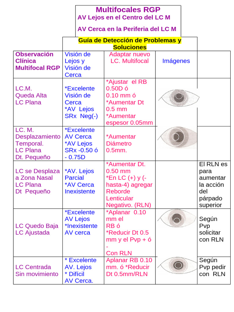 Guía de Ajustes para Lentes RGP Multifocales | PDF