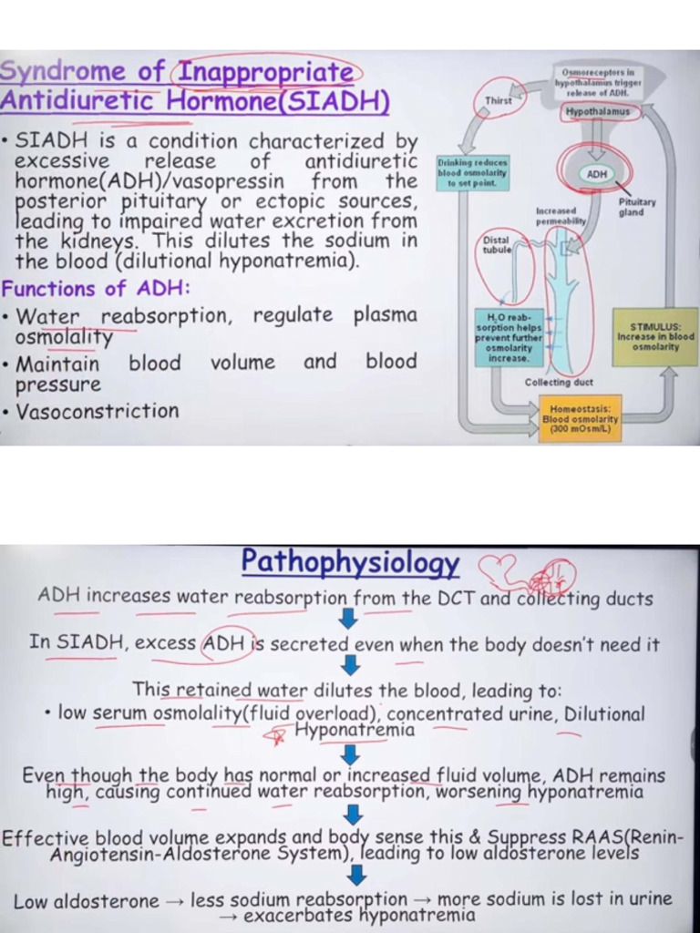 Siadh Pdf