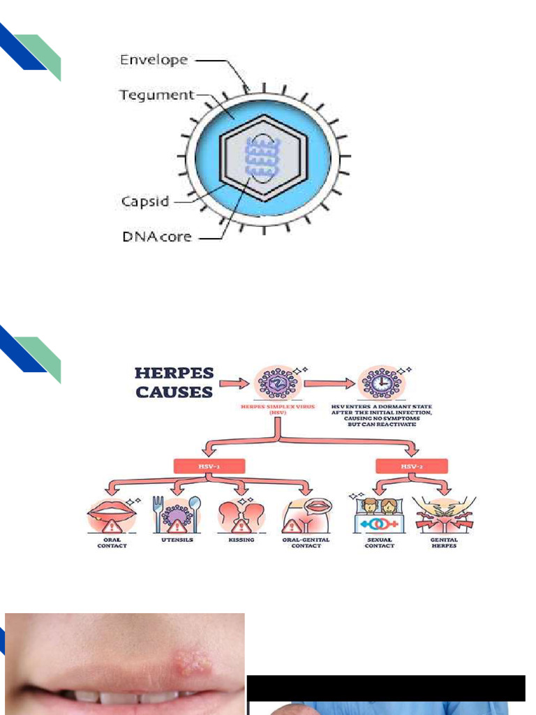 Herpes Viruses Images | PDF
