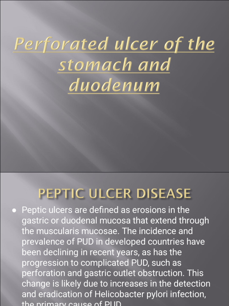 Perforated Ulcer of The Stomach and Duodenum | PDF | Stomach | Medical ...