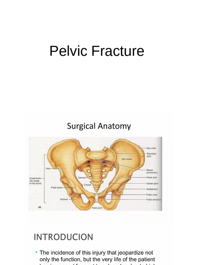 Pelvic Fracture | PDF