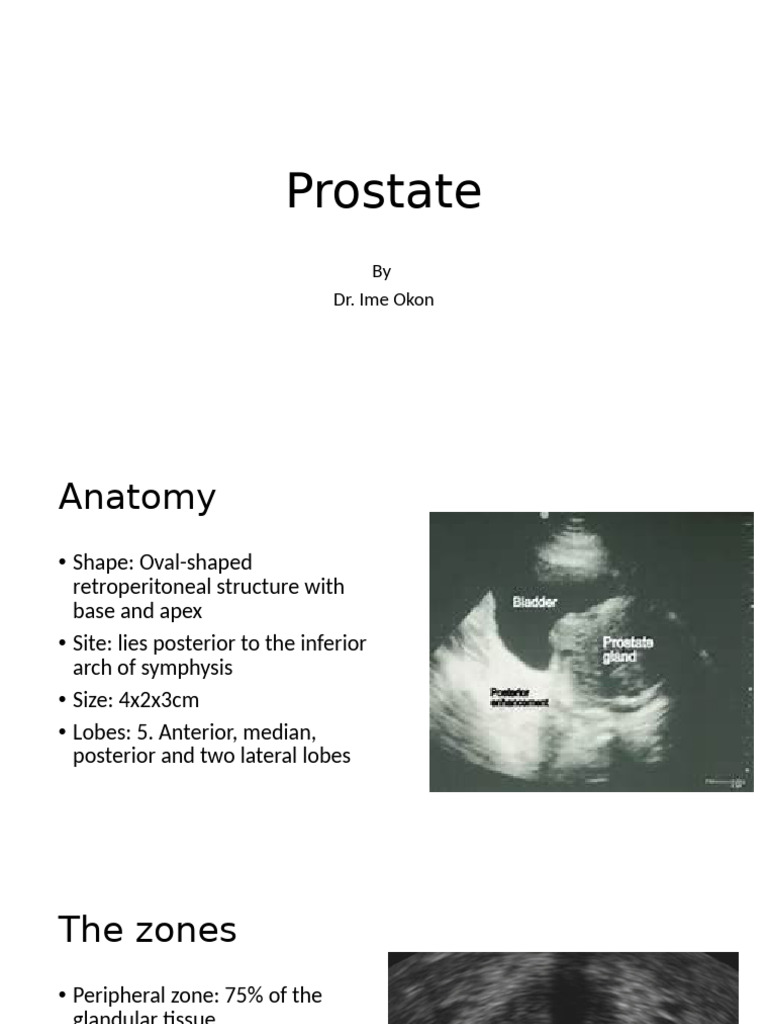 Prostate Zones and Ultrasound Techniques | PDF | Prostate | Prostate ...