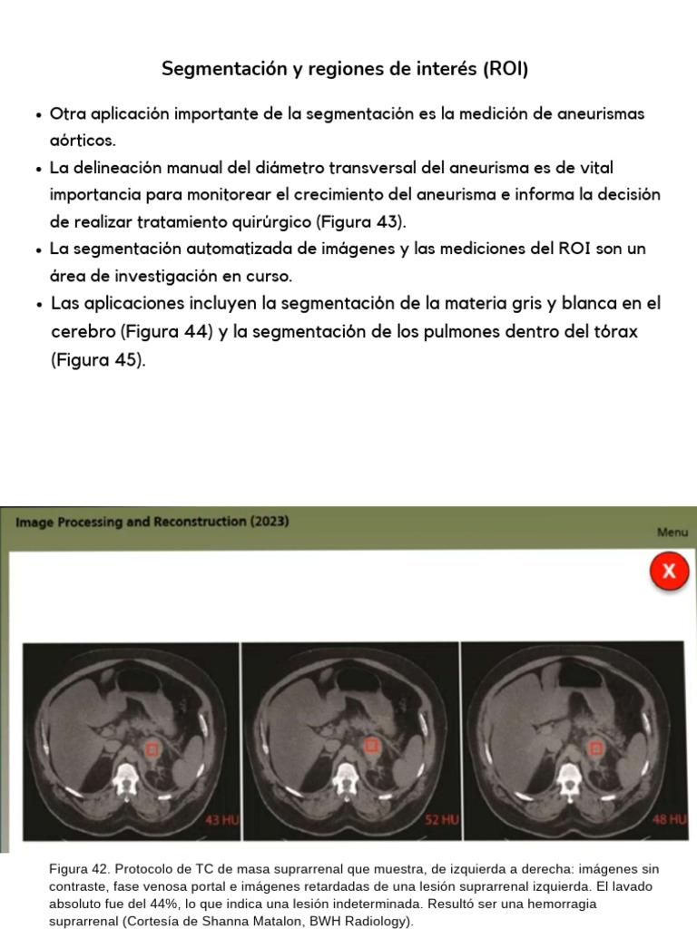 CamScanner 12-04-2025 10.36.pdf - 20250412 - 134110 - 0000 | PDF | Ct Scan