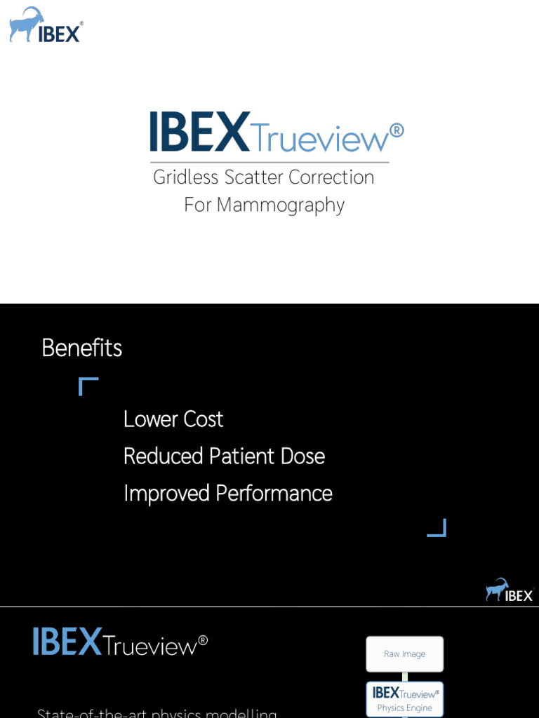 IBEX Trueview Gridless Scatter Correction For Mammography | PDF | Mammography | Medical Imaging