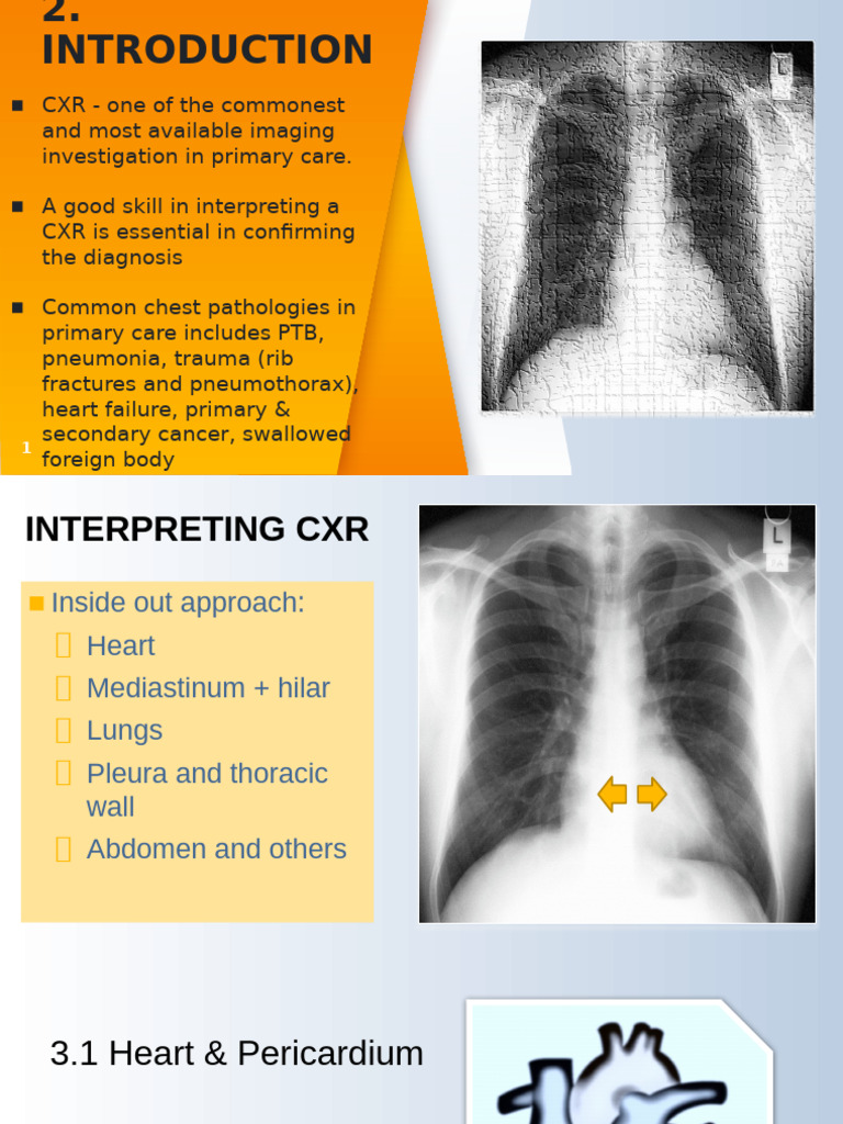 Chest Pathology in CXR Interpretation | PDF | Lung | Thorax