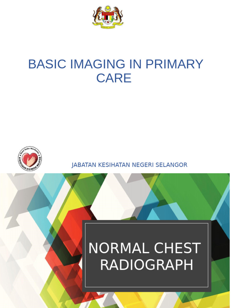 Module 1 Normal Chest X-Ray | PDF | Heart | Lung