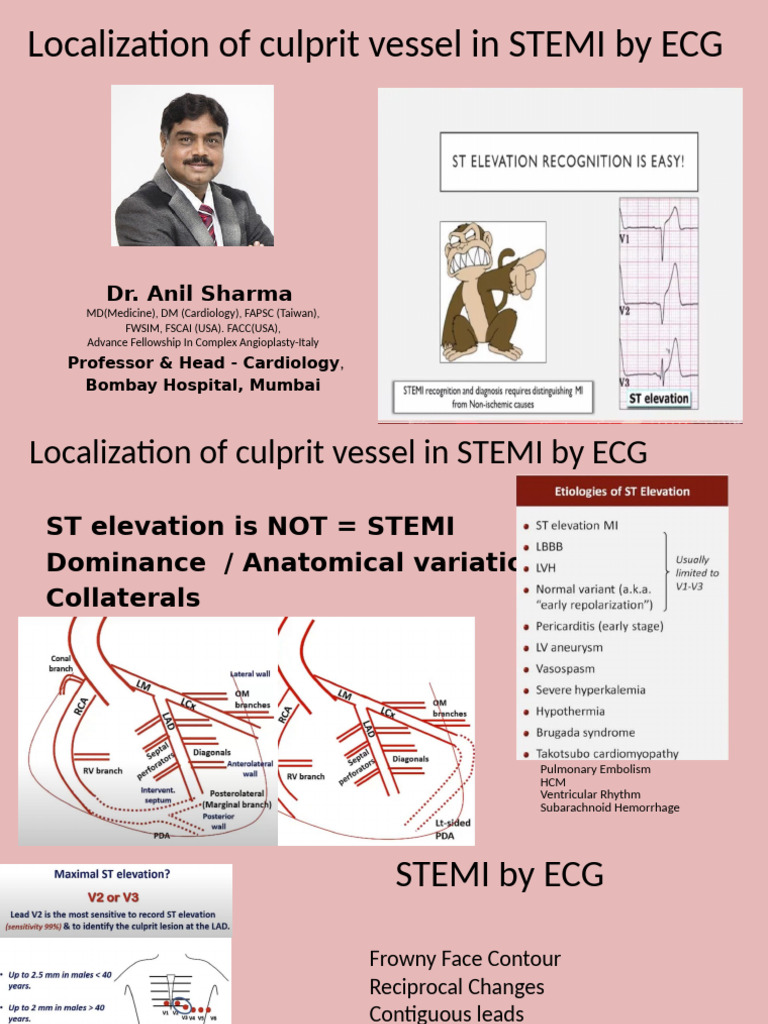 11 ECG STEMI Culprit Vessel Final | PDF