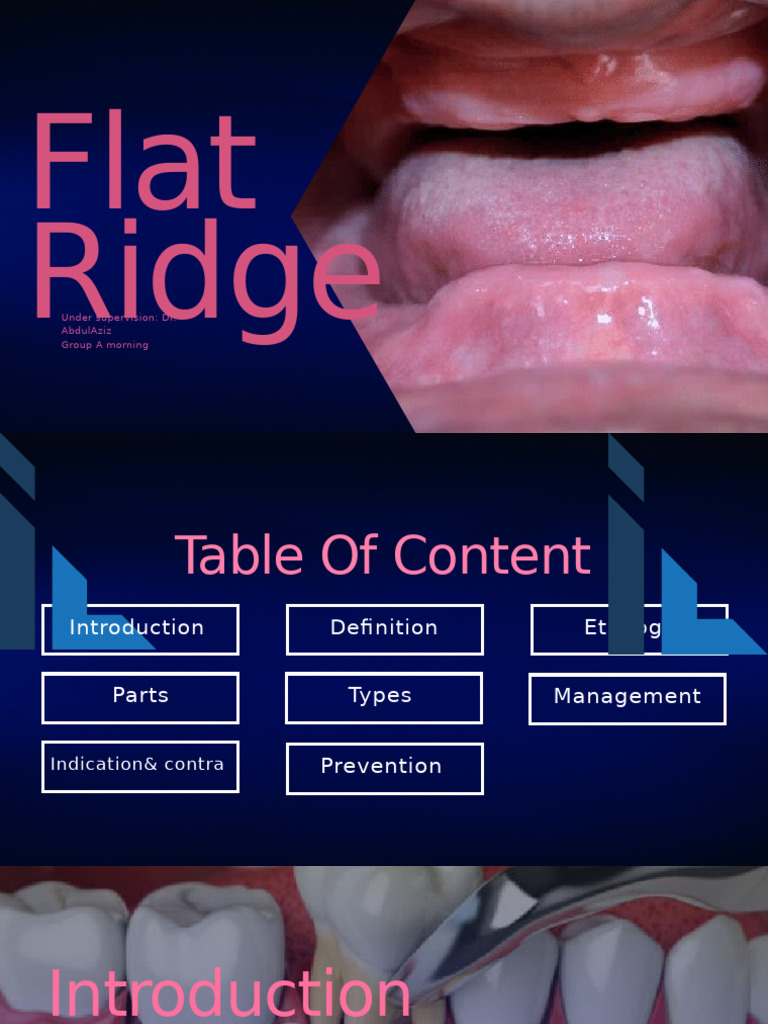 Understanding Flat Ridge Anatomy | PDF | Dental Implant | Dentures