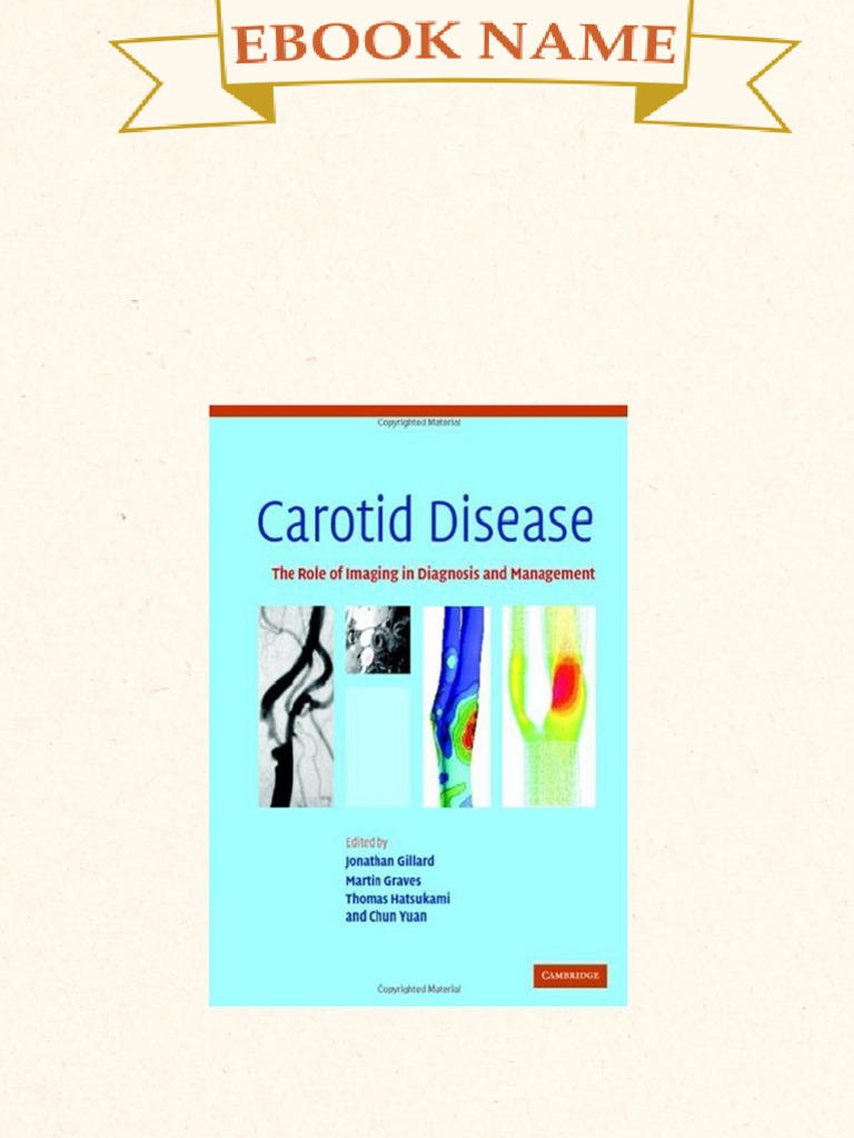 Carotid Disease The Role of Imaging in Diagnosis and Management 1st Edition Jonathan Gillard ...