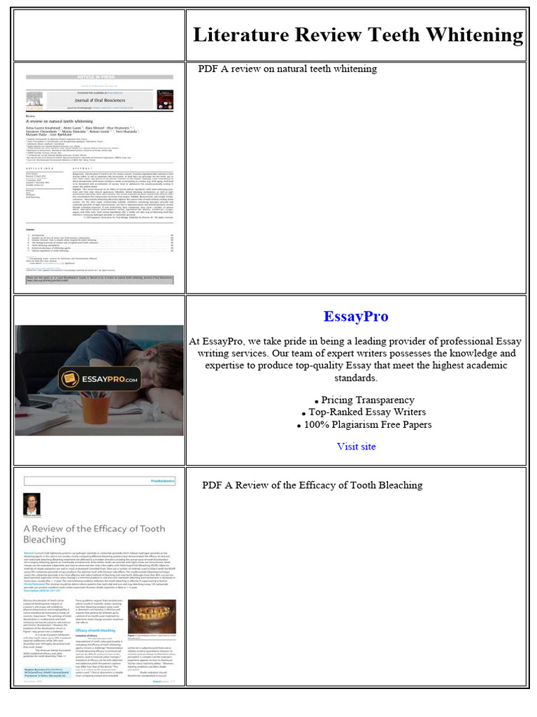 Literature Review Teeth Whitening | PDF