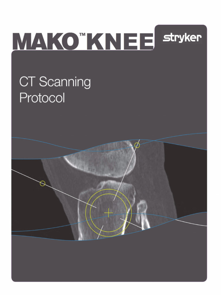 MAKO Knee CT Protocol 1745230796 | PDF | Knee | Ankle