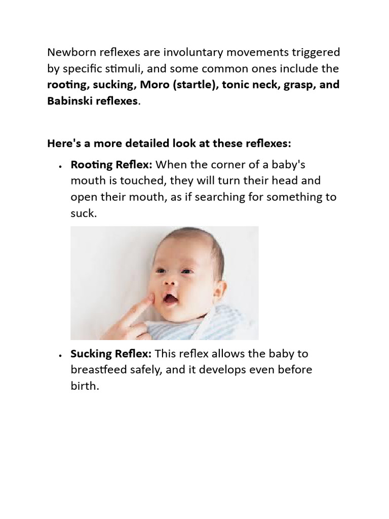 Reflexes in New Born | PDF