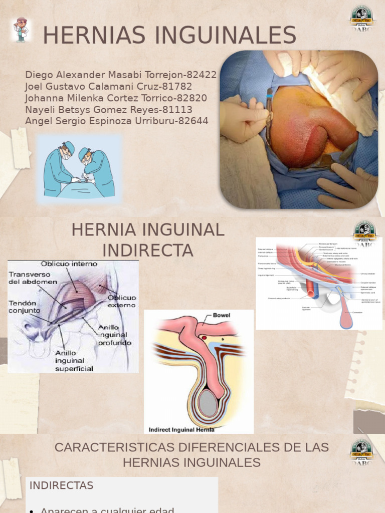 Hernia Inguinal | PDF | Examen físico | Especialidades Medicas